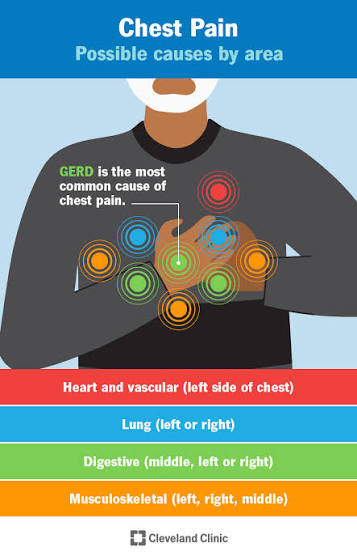 Chest pain causes diagnosis and treatment#